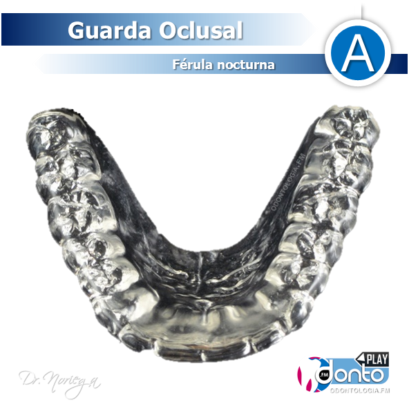Guarda Oclusal :: OdontologiaFM